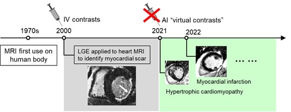 How artificial intelligence is shaping medical imaging | University of Oxford